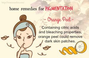 Top 18 Home Remedies For Pigmentation On Face And Neck