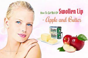 21 Tips How To Get Rid Of Swollen Lip Symptoms Fast At Home