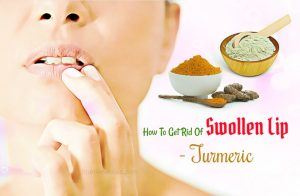 21 Tips How To Get Rid Of Swollen Lip Symptoms Fast At Home