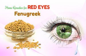 27 Natural Effective Home Remedies For Red Eyes Infections