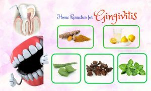 20 Quick Home Remedies For Gallbladder Pain Relief