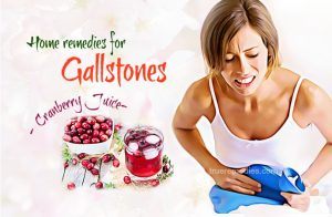 20 Natural Home Remedies For Gallstones Pain Relief