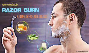 31 Home Remedies For Razor Burn & Bumps On Face, Neck, Legs