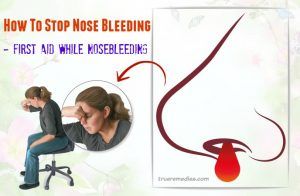 20 Easy Tips How To Stop Nose Bleeding Fast At Home