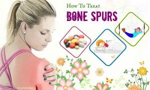 20 Tips How To Treat Bone Spurs In Neck, Back, Hip & Knee