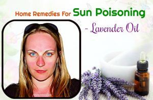 19 Home Remedies For Sun Poisoning Rash & Blisters On Lips & Face
