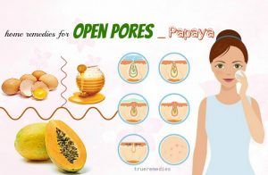 24 Home Remedies For Open Pores On Face, Nose & Cheeks