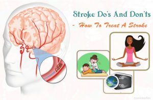 12 Must-Remember Stroke Do’s And Don’ts For Stroke Patients